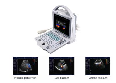 China B Ultrasound Scanner Portable Doppler Ultrasound Machine with Only 4.5Kgs Weight for sale