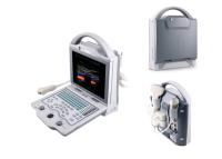 China B Ultrasound Scanner Portable Doppler Ultrasound Machine with Only 4.5Kgs Weight for sale