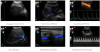 China Ultrasound Scan Machine Portable Ultrasound Scanner with Scanning Depth 320mm for sale