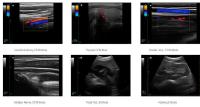China Ultrasound Scan Machine Portable Ultrasound Scanner with Scanning Depth 320mm for sale