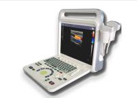 China 4d Ultrasound Equipment Portable Ultrasound Scanner With Phased Array Probe of Center Frequency 3MHz for sale