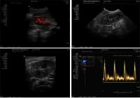 China 4d Ultrasound Equipment Portable Ultrasound Scanner With Phased Array Probe of Center Frequency 3MHz for sale