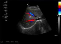 China Digital Ultrasound Scanner Portable UItrasound Scanner 4D Cardiac Probe Optional for sale