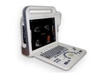 China Digital Ultrasound Scanner Portable UItrasound Scanner 4D Cardiac Probe Optional for sale