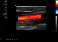 China Ultrasound Imaging Machine Portable Ultrasound Scanner with 160G Capacity for sale