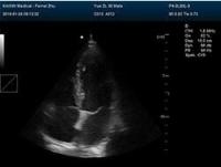 China B Ultrasound Scanner Portable Ultrasound Scanner with Built-in 4D Module with Optional 4D Volume Probe for sale