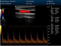 China B Ultrasound Scanner Portable Ultrasound Scanner with Built-in 4D Module with Optional 4D Volume Probe for sale