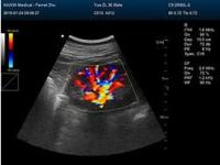 China Portable Color Doppler Portable Ultrasound Scanner with Detectable depth of 2~30cm for sale