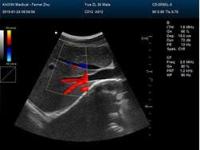China Portable Color Doppler Portable Ultrasound Scanner with Detectable depth of 2~30cm for sale
