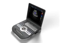 China Portable Ultrasound Device Portable Ultrasound Scanner Color Doppler with 2 USB Ports for sale