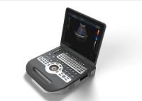 China 4d Ultrasound Machine Portable Ultrasound Scanner With 120G Capacity 4800 Frames​ Cine Loop for sale