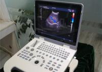 China 4d Ultrasound Machine Portable Ultrasound Scanner With 120G Capacity 4800 Frames​ Cine Loop for sale