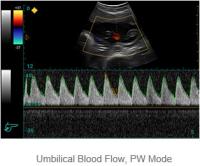 China Color Doppler Ultrasound System Portable Ultrasound Scanner With 12.1 Inch LED Monitor And 2 Probe Ports for sale
