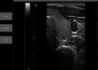 China Pocket Ultrasonic Diagnostic Equipment Portable Ultrasound Scanner Supported Window 10 VET Use Available for sale