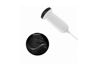 China USB Ultrasound Probe Digital Portable Ultrasound Scanner With Probe of Frequency 2~15MHz for sale