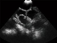 China Digital Medical Veterinary Ultrasound Scanner for sale