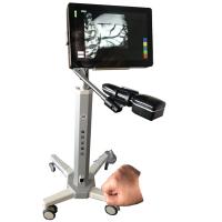 China No Radiation Clear And Accurate Infrared Vein Finder With 2 Million Pixels Infrared Camera for sale