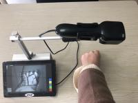 China No Radiation Clear And Accurate Infrared Vein Finder With 2 Million Pixels Infrared Camera for sale