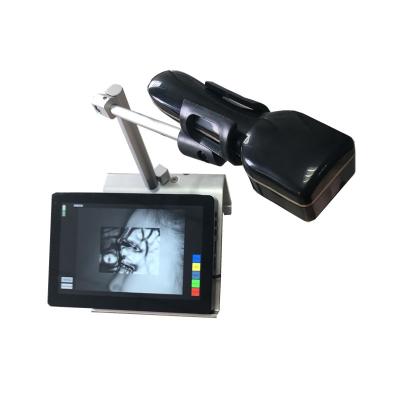 China Accuracy < 0.2mm Medical Vascular Imager Infrared Vein Finder Vein Detected for Obese Aged Patients for sale