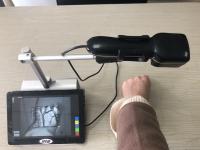 China Vascular Projection Infrared Light Portable Vein Finder Finding Veins By Projecting to Human Skin for sale