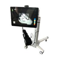 China 2 Million Pixels Infrared Camera Portable Infrared Vein Finder Vascular Detector Without Radiation for sale