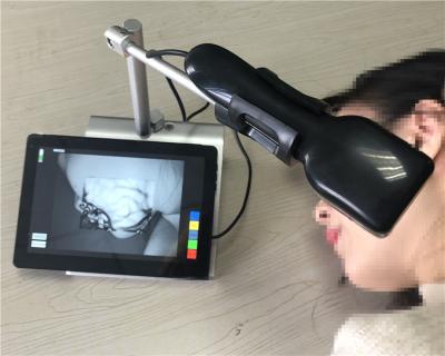 China Safe Portable Infrared Vein Locator Device Vein Scanner Screen Displayed for sale