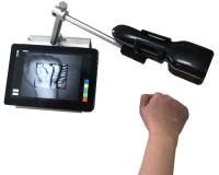 China 850nm Wavelength Infrared Vein Finder Vein Viewer Version Instrument Suitable For Children Adult Vet for sale