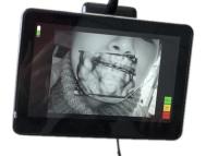 China 850nm Wavelength Infrared Vein Finder Vein Viewer Version Instrument Suitable For Children Adult Vet for sale