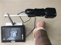 China Medical Portable Vein Locator Device Spider Vein Removal Machine Imaging Depth < 10mm for sale