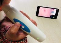 China 2 Million Digital Skin Moisture Analyzer Displaying Data Of Oil Water Pigment Flexible for sale