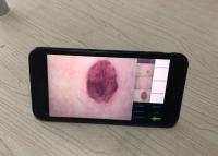 China Skin Moisture Detector Wireless Digital Skin Analyzer To Observe Surface Of Skin Derm Pores for sale