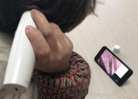 China Skin Analysis Device Digital Skin Analyzer Connected To Mobilephone With Only 100g Weight for sale