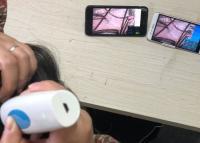 China Skin Moisture Sensor Digital Skin Analyzer With Skin Lense And Scalp Lense for sale
