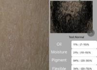 China Digital Portable Skin Moisture Analyzer With APP Downloaded To Mobilephone for sale