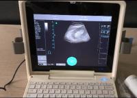 China 12 Inch LED Screen Portable Digital Ultrasound Scanner with All Kinds of Probes for sale