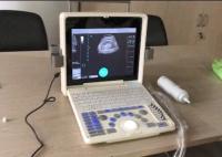 China 12 Inch LED Screen Portable Digital Ultrasound Scanner with All Kinds of Probes for sale
