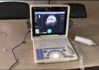 China 12 Inch LED Screen Portable Digital Ultrasound Scanner with All Kinds of Probes for sale