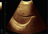 China 12 Inch LED Screen Portable Digital Ultrasound Scanner with All Kinds of Probes for sale