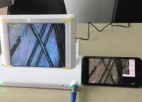 China Digital Magnifier Handheld Video Dermatoscope Skin Analyzer with Data Report of Oil Moisture Pigment Flexible for sale