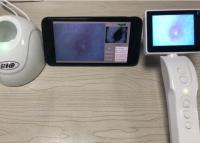 China Digital Magnicication Video Dermatoscope Skin and Scalp Analyzer with 50, 200 Times Lens for sale
