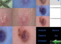 China Skin and Scalp Detector Video Dermatoscope with Analysisi Report of Moisture Oil Pigment Flexible for sale