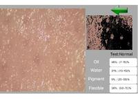 China Digital Portable Skin Camera Video Dermatoscope Hair Digital Camera with 200 Times Magnification for sale