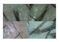 China Digital Microscope for Skin and Scalp Video Dermatoscope with 2 Million Pixels for sale