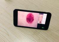 China Hair Skin Analysis Video Dermatoscope Skin Water Oil Pigment Flexible Detector with Data Report for sale