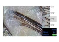 China Hair Magnifier Video Dermatoscope Dermal Videoscope with Resolution Up To 1280X960 for sale