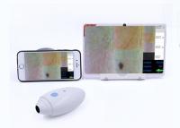 China HD Digital Video Dermatoscope Skin Hair Scanner Wireless Connected to Mobilophone Supported IOS Andriod for sale