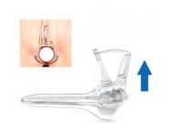 China AAA Batteries Digital Video Colposcopy Equipment for sale
