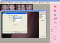 China Digital Scope ENT Scope Digital Intra Oral Camera with USB Connected to Computer Software FREE for sale