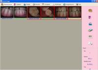 China Teeth Camera Digital Video Intra Oral - scope  with Two Keys Only Tooth Camera Pixels of 1200*1600 for sale