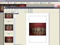 China Teeth Camera Digital Video Intra Oral - scope  with Two Keys Only Tooth Camera Pixels of 1200*1600 for sale